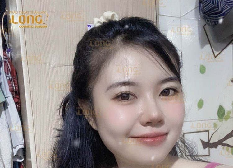 10 Địa chỉ phẫu thuật tạo má lúm đồng tiền tại TPHCM uy tín nhất - Sài Gòn Review