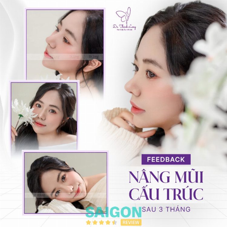 7 Bác sĩ nâng mũi tại TPHCM đẹp, an toàn, chuyên môn cao - Sài Gòn Review